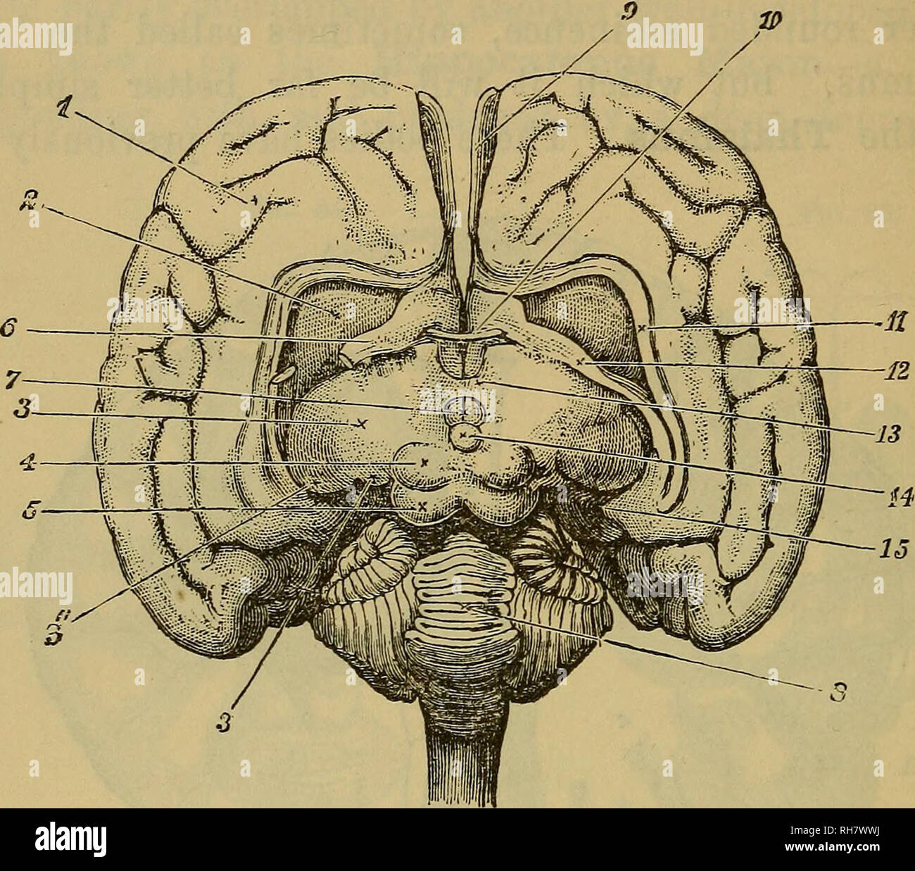 Corpora Quadrigemina Corpora Quadrigemina | Radiology Reference