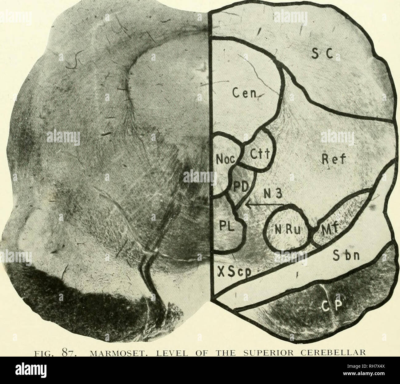 . The brain from ape to man; a contribution to the study of the ...