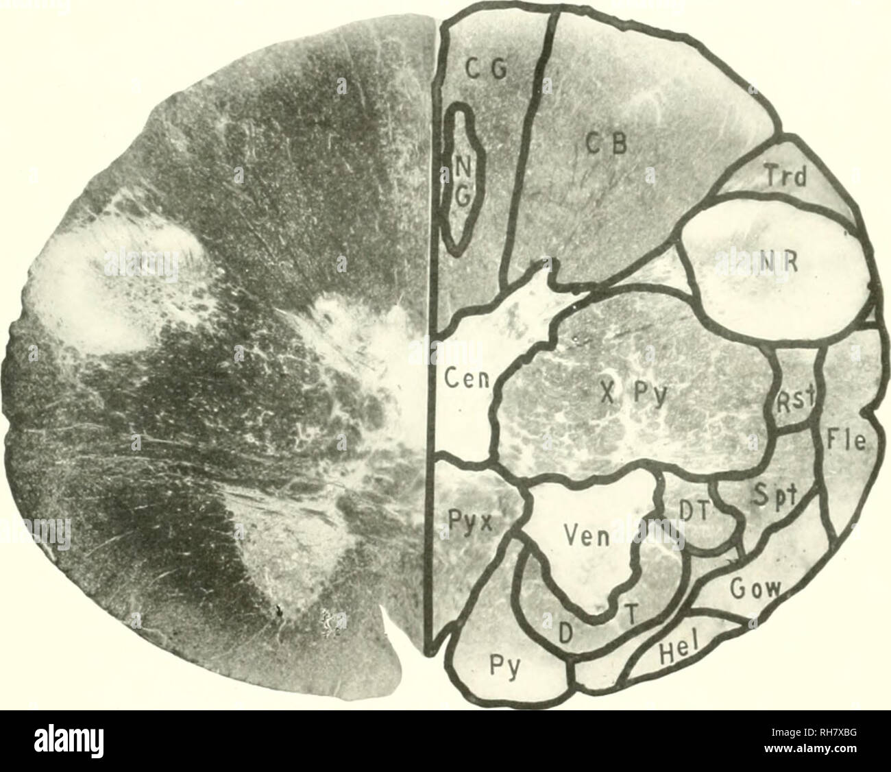 Human evolution brain size hi-res stock photography and images - Alamy
