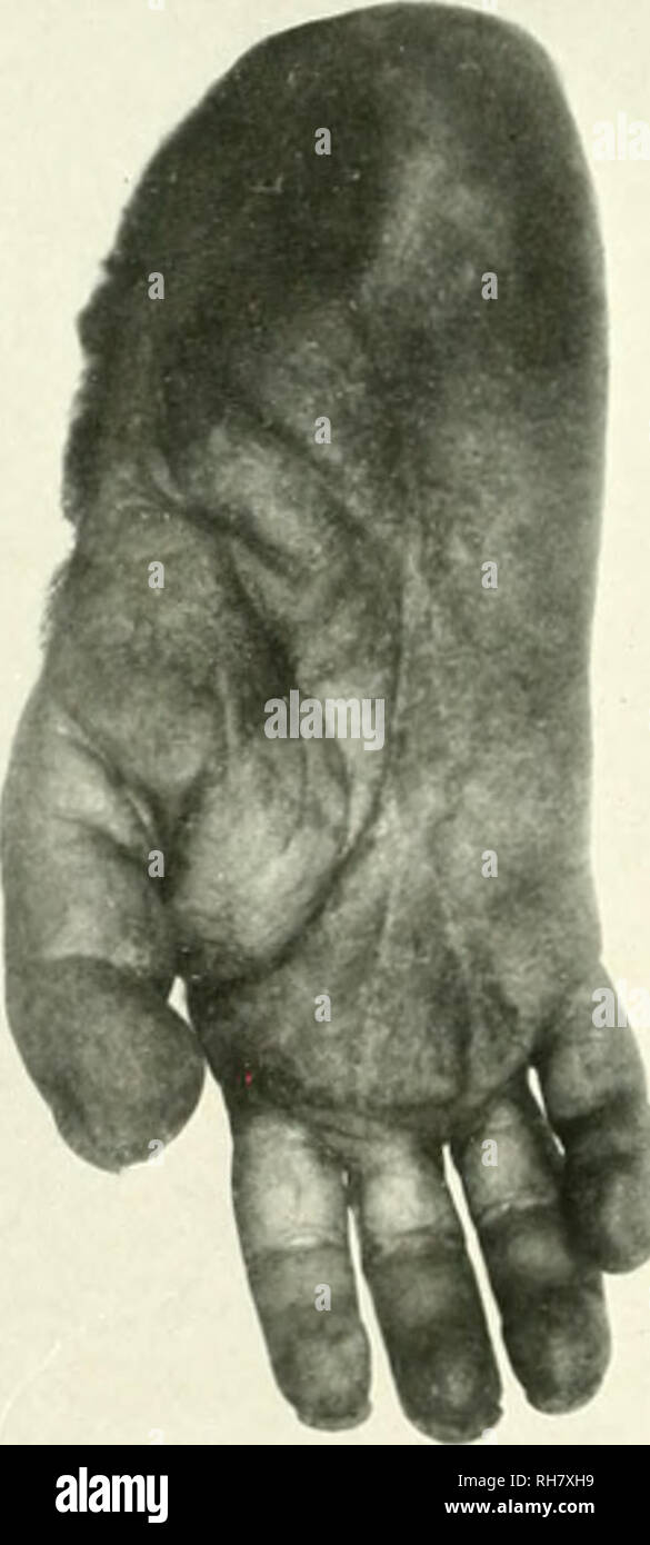 Human toe evolution hi-res stock photography and images - Alamy