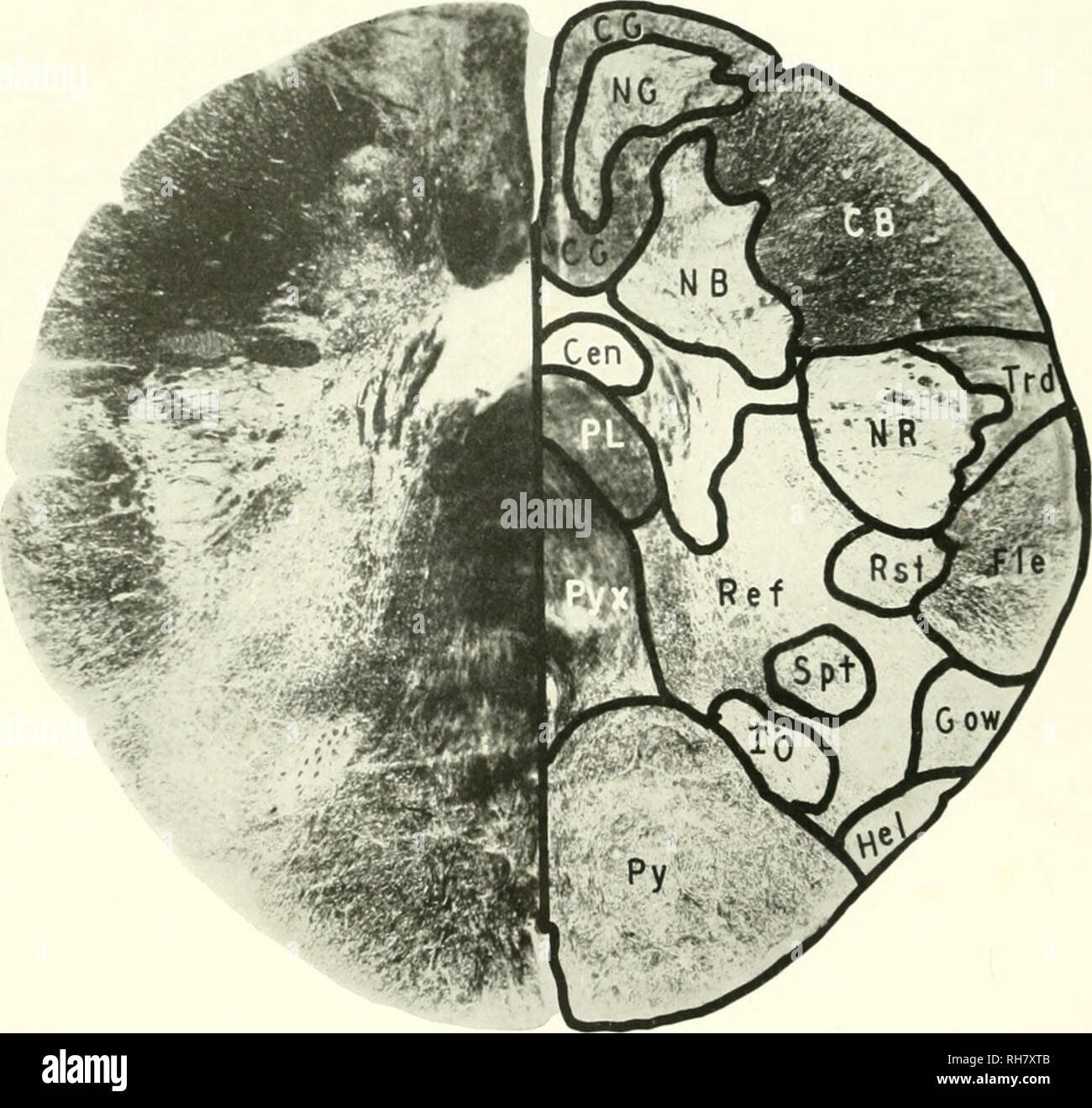 . The brain from ape to man; a contribution to the study of the ...