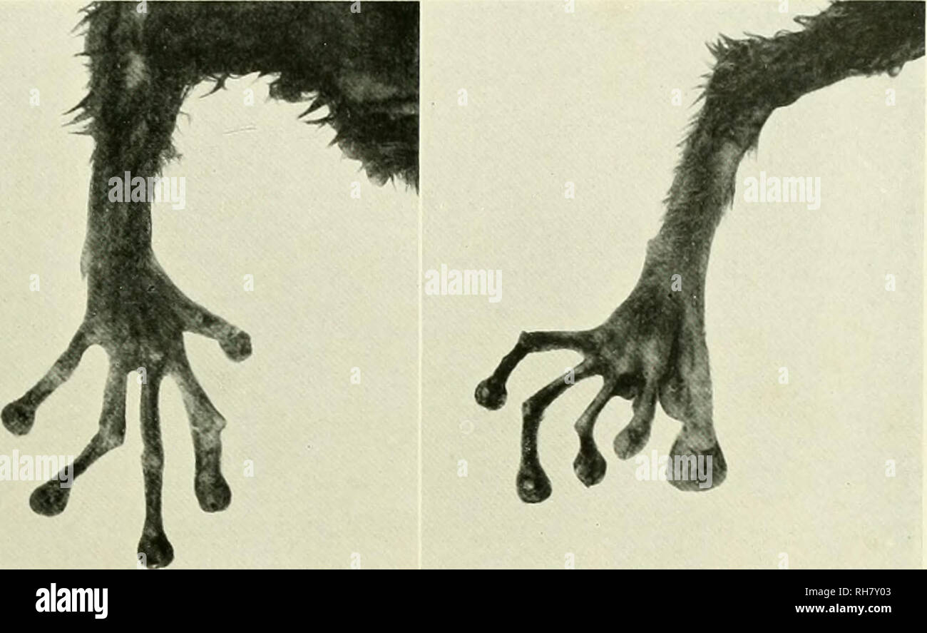 Dorsum of foot hi-res stock photography and images - Alamy