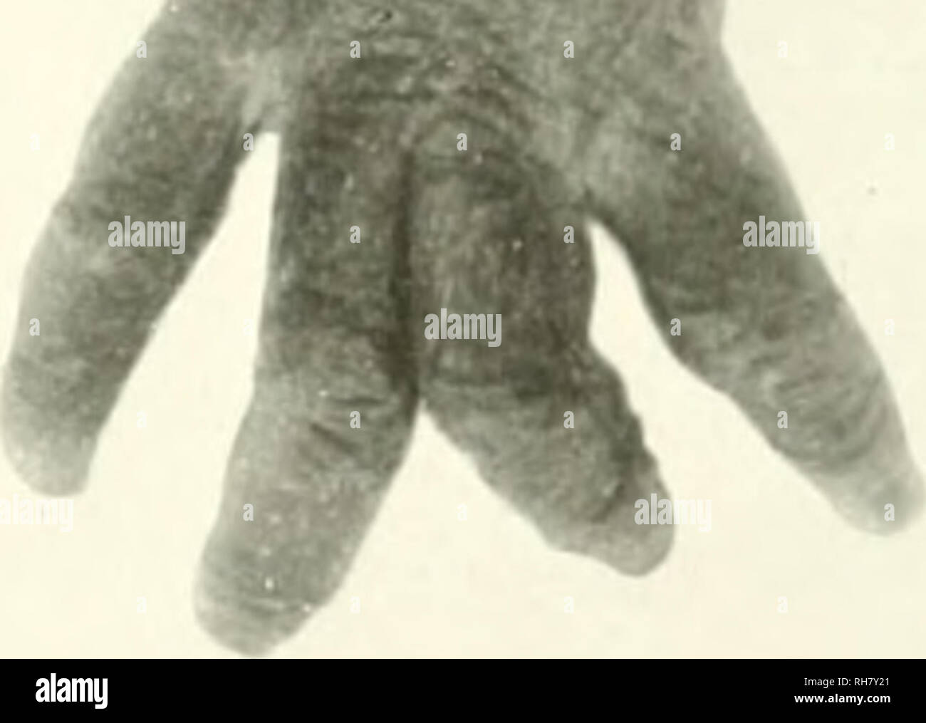 Human brain trees hi-res stock photography and images - Alamy