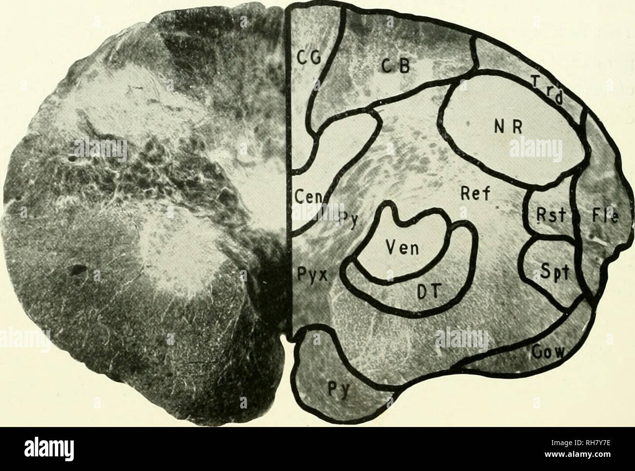. The brain from ape to man; a contribution to the study of the ...