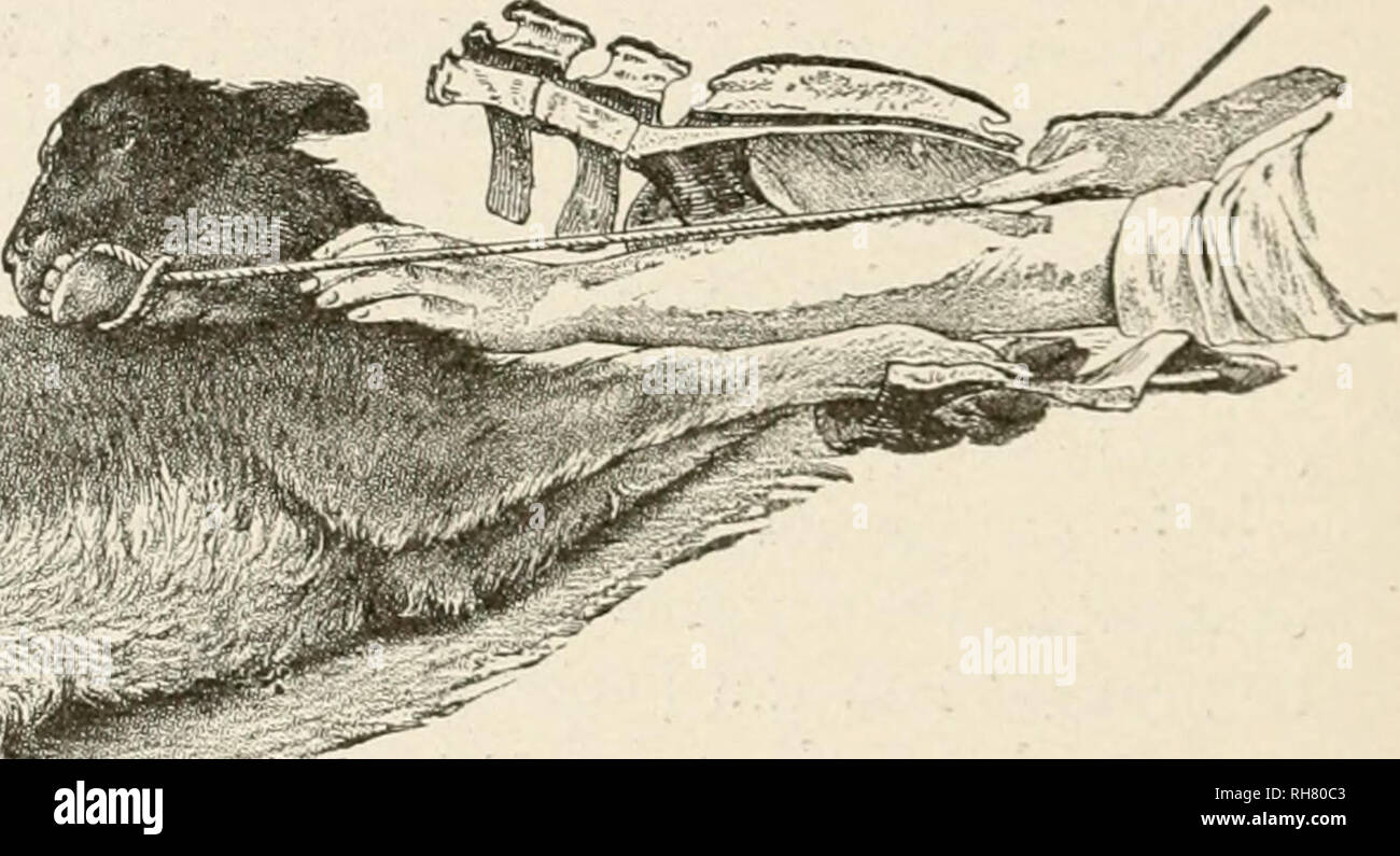 Lateral deviation hi-res stock photography and images - Alamy