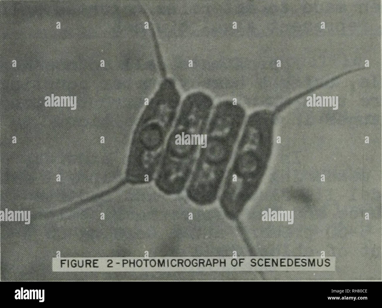 Single celled algae cells of the genus hi-res stock photography and ...