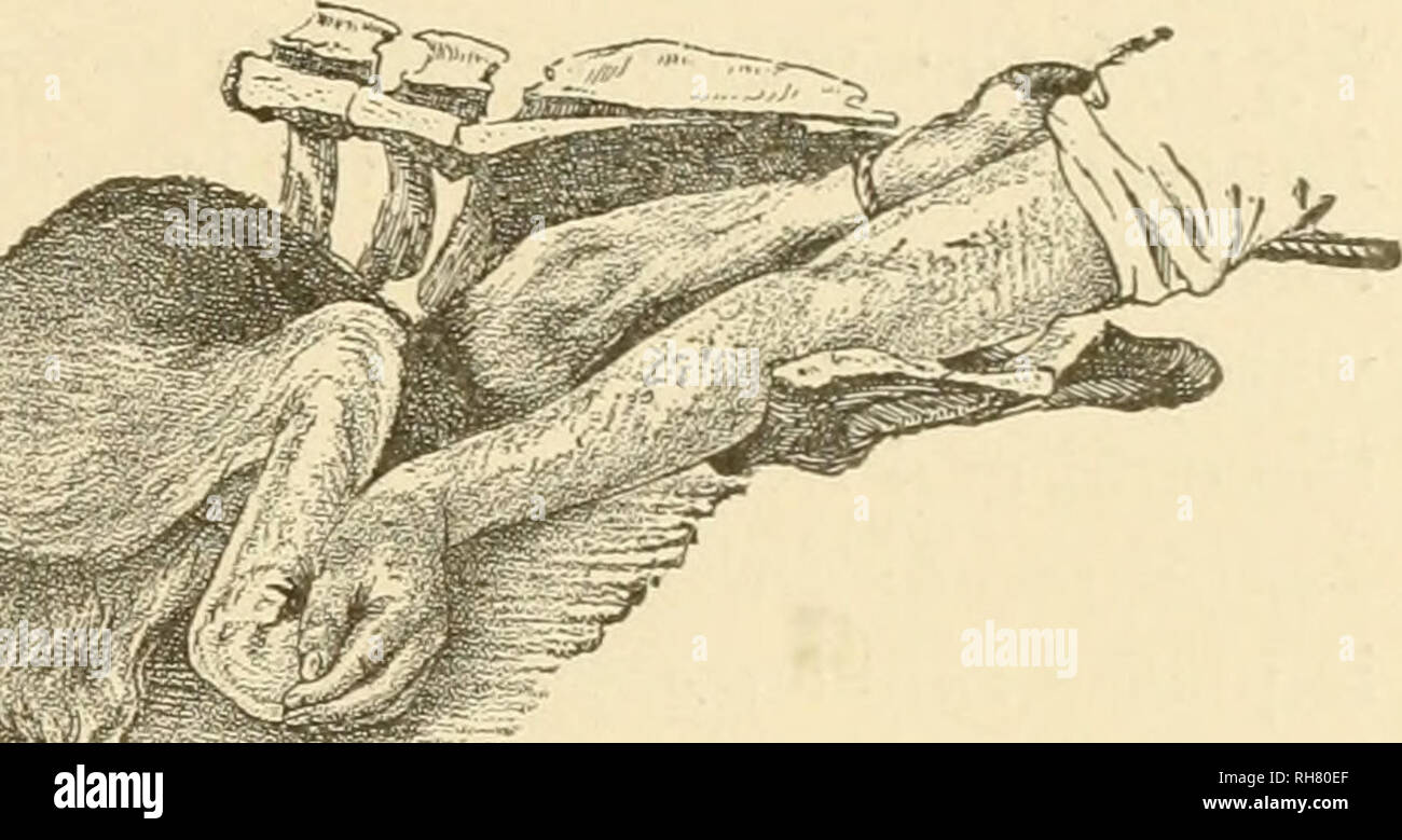 Calfs leg hi-res stock photography and images - Alamy