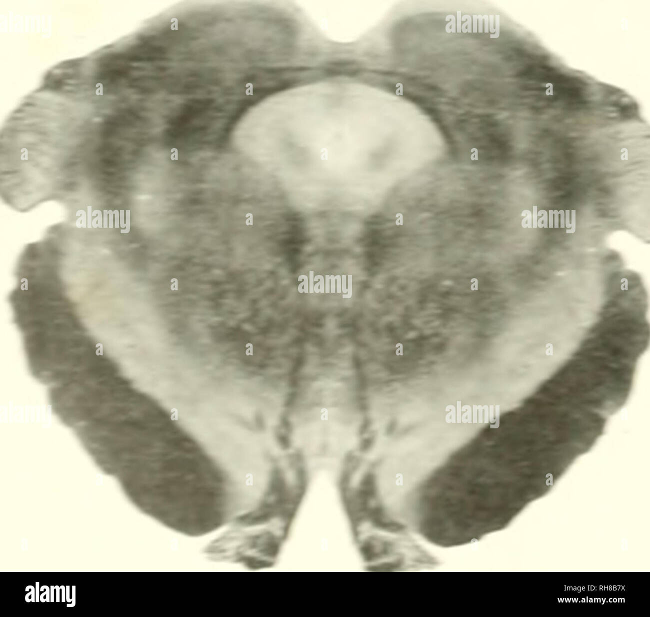 . The brain from ape to man; a contribution to the study of the ...