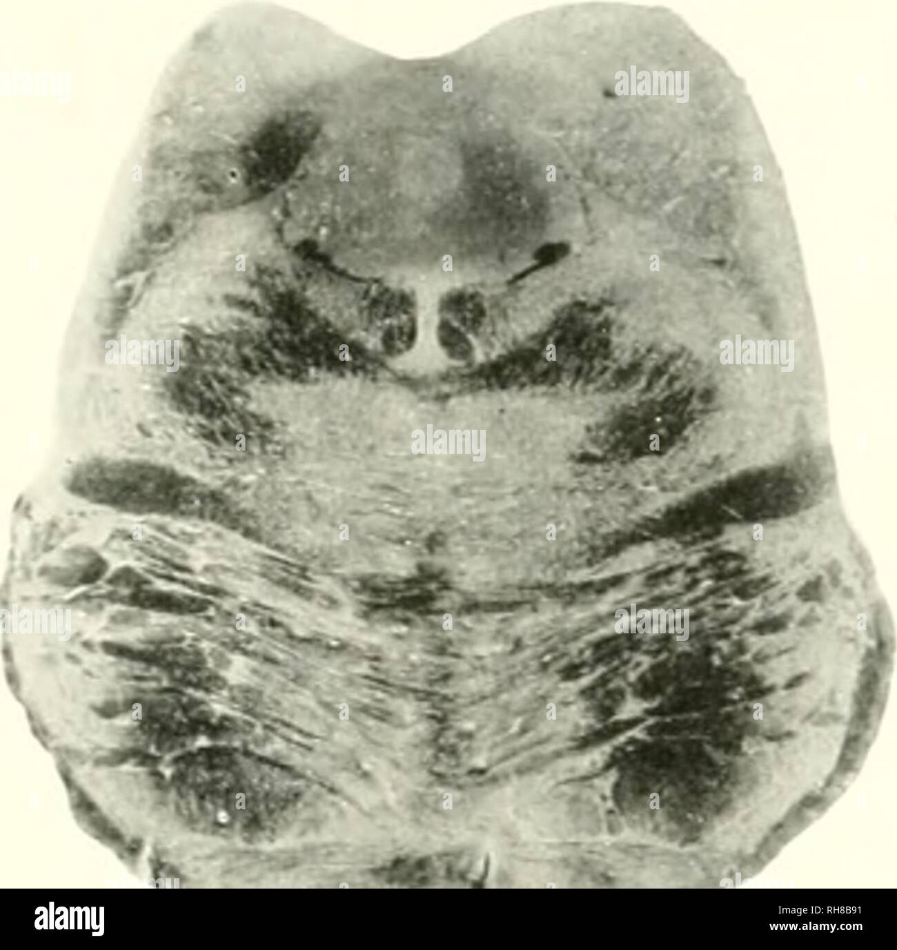 Evolution Of Man From Ape High Resolution Stock Photography and Images ...