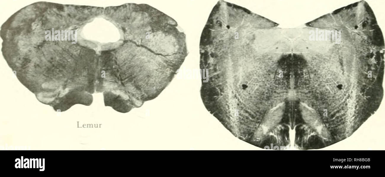. The brain from ape to man; a contribution to the study of the ...