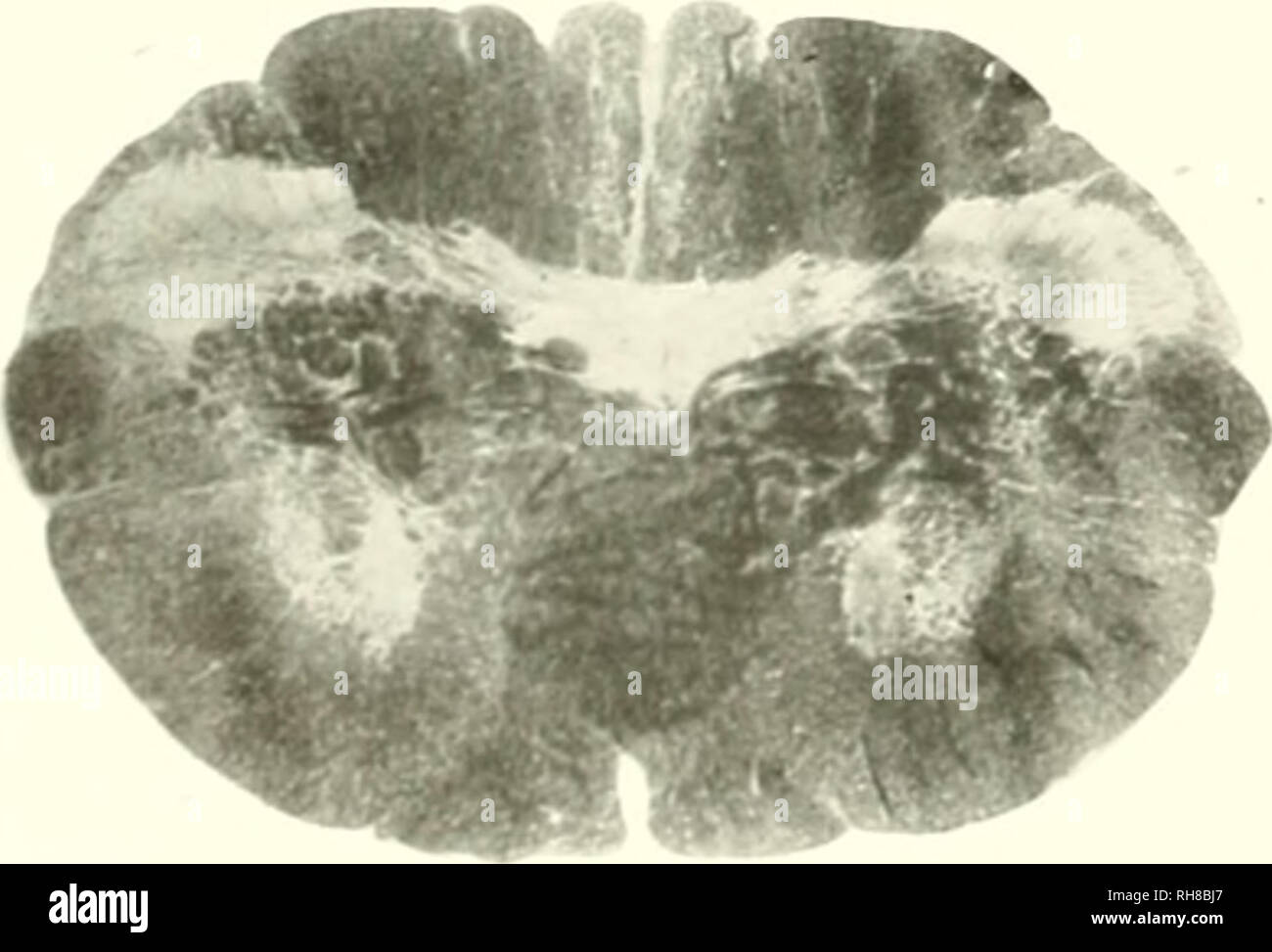 Marmoset brain hi-res stock photography and images - Alamy