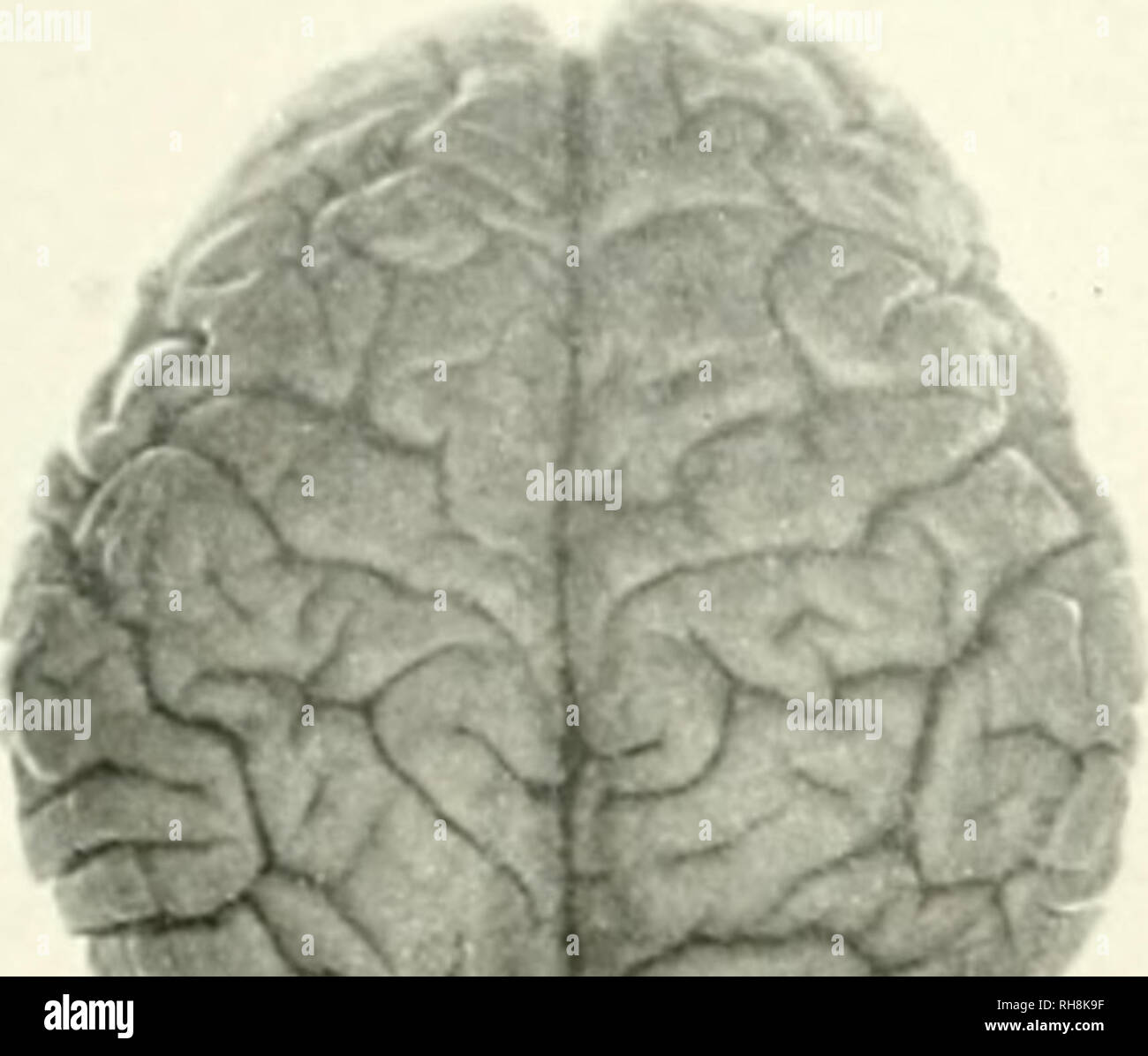 Human chimpanzee brain hi-res stock photography and images - Alamy
