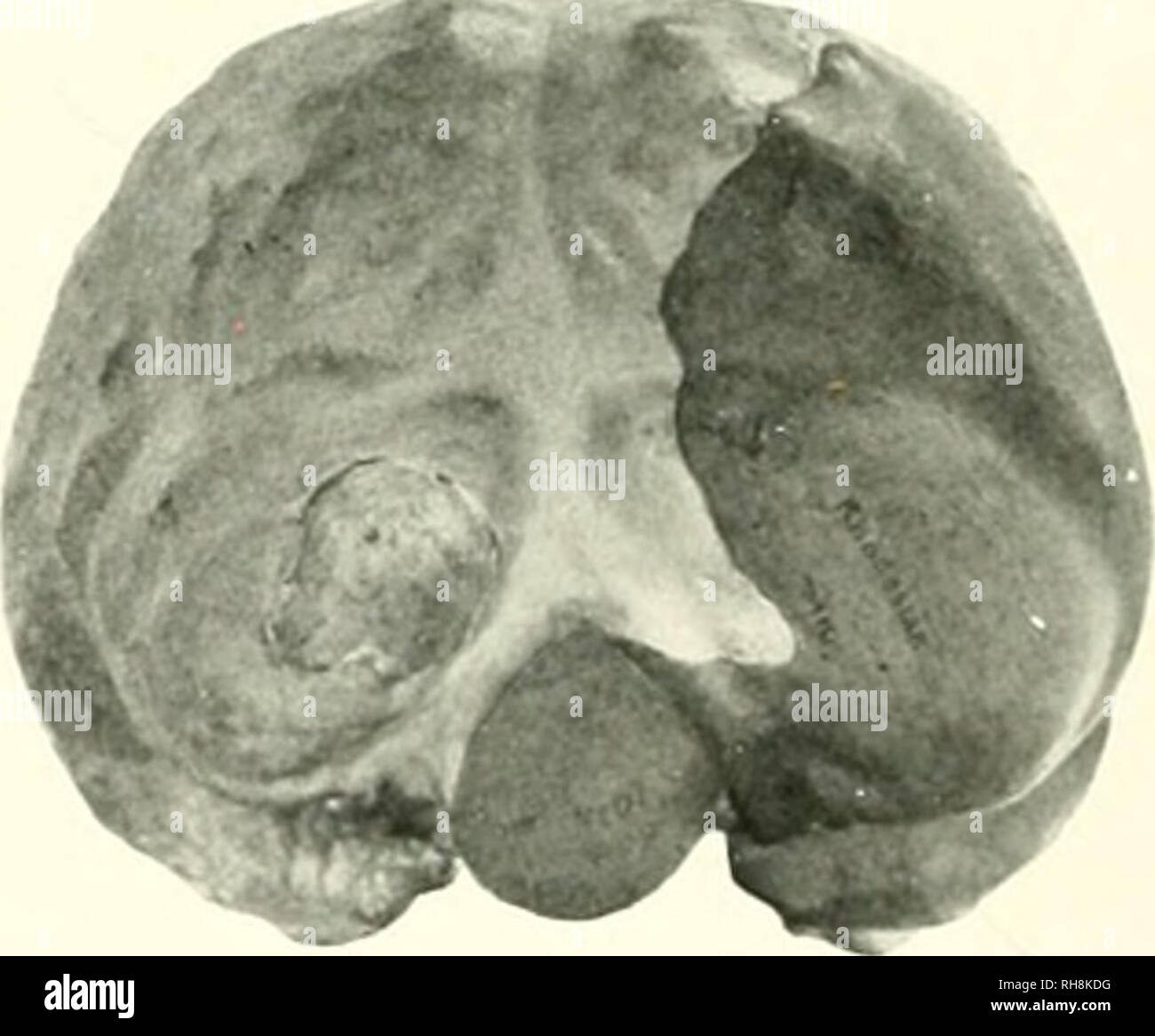 Ape human brain hi-res stock photography and images - Alamy