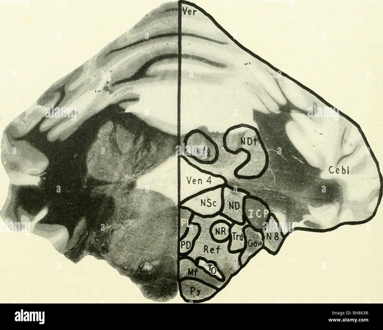 . The brain from ape to man; a contribution to the study of the ...