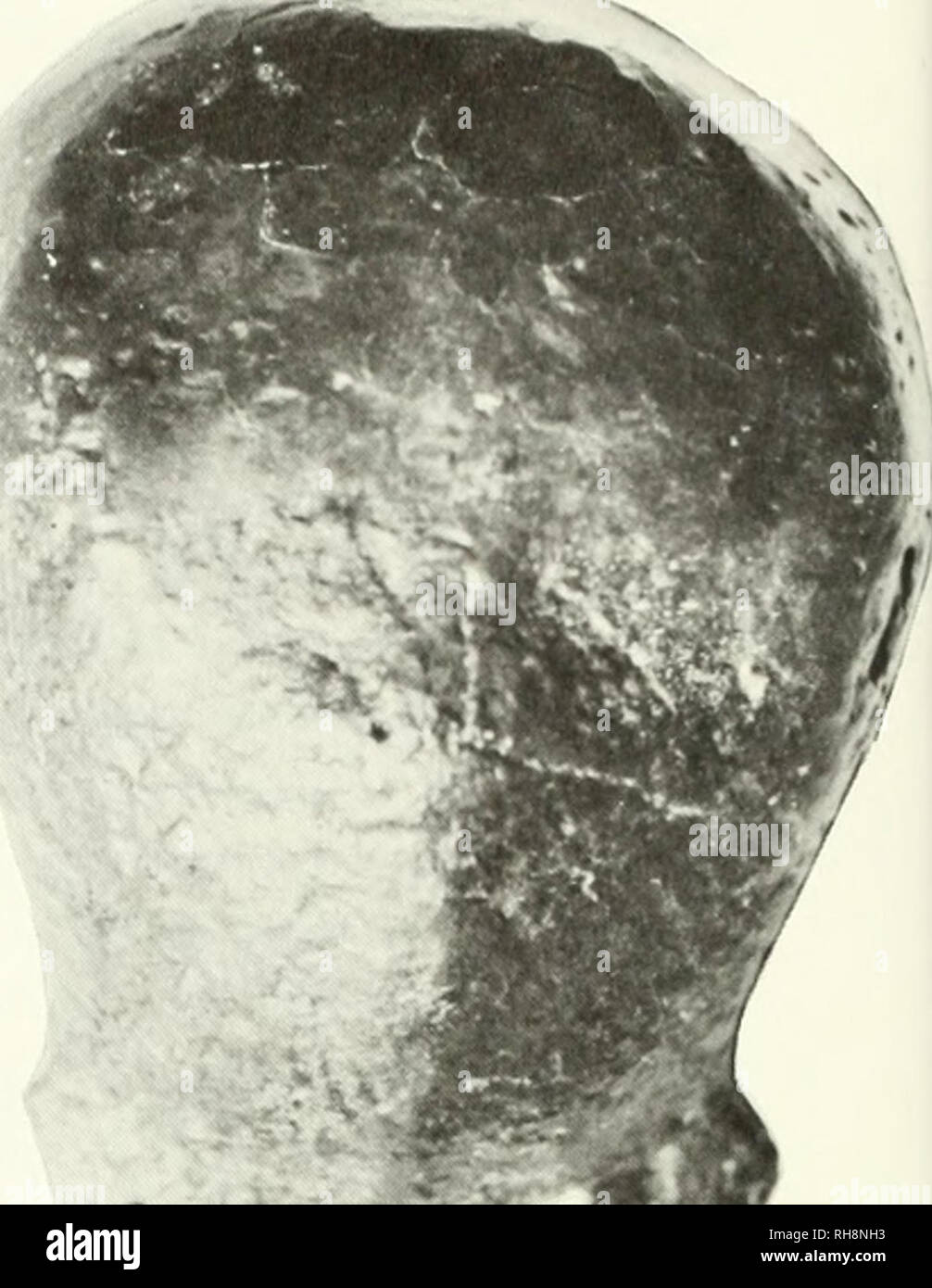 . The brain in hominid evolution. Human evolution; Brain; Fossil ...
