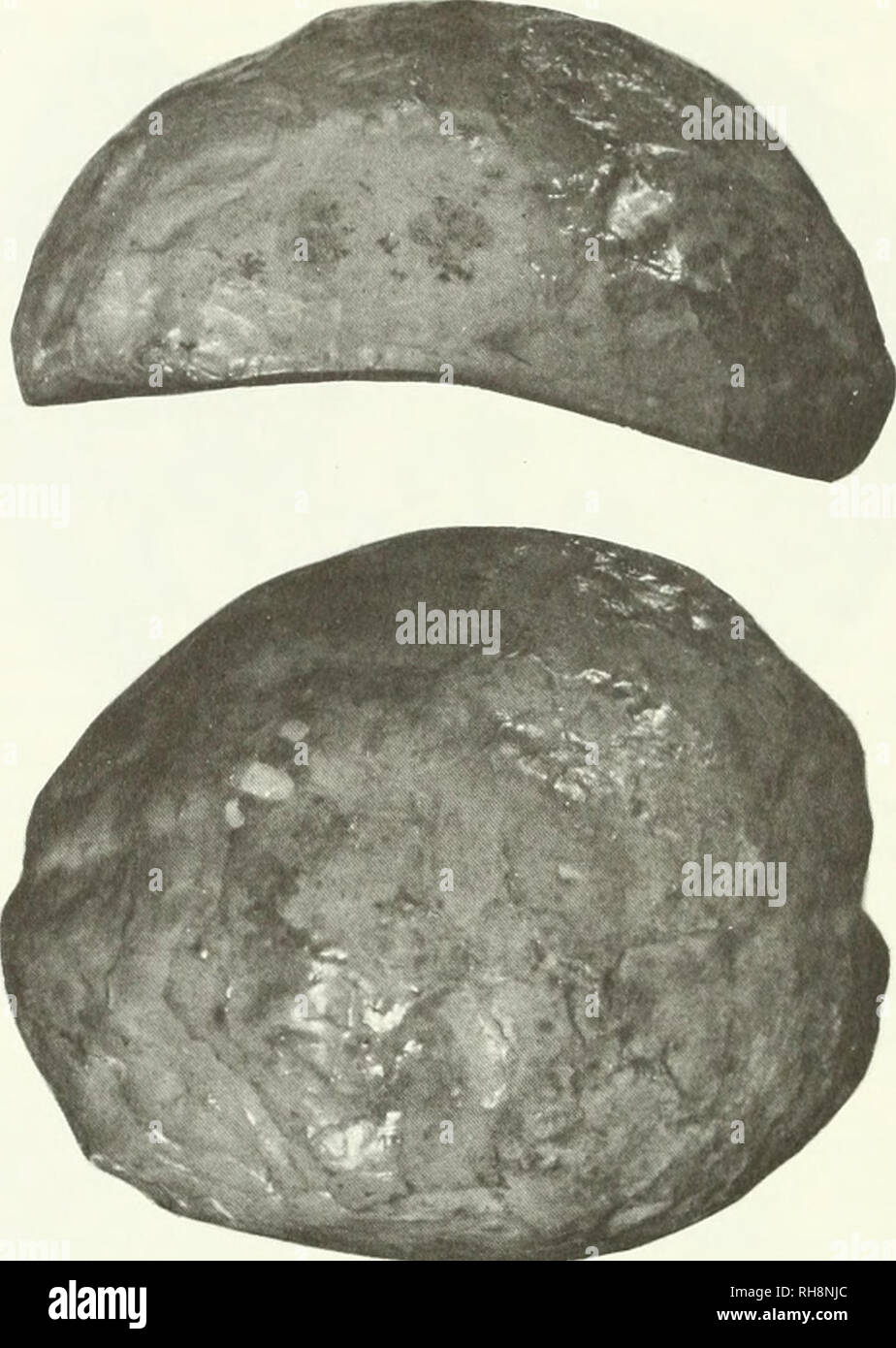 Human endocast hi-res stock photography and images - Alamy