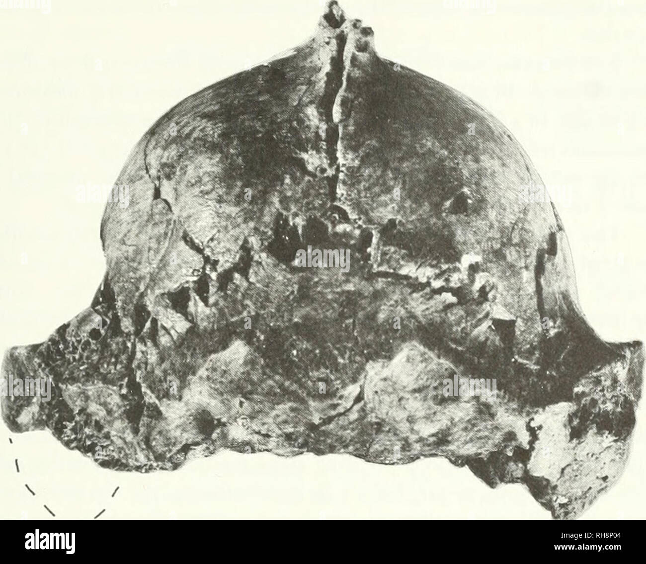 . The brain in hominid evolution. Human evolution; Brain; Fossil ...