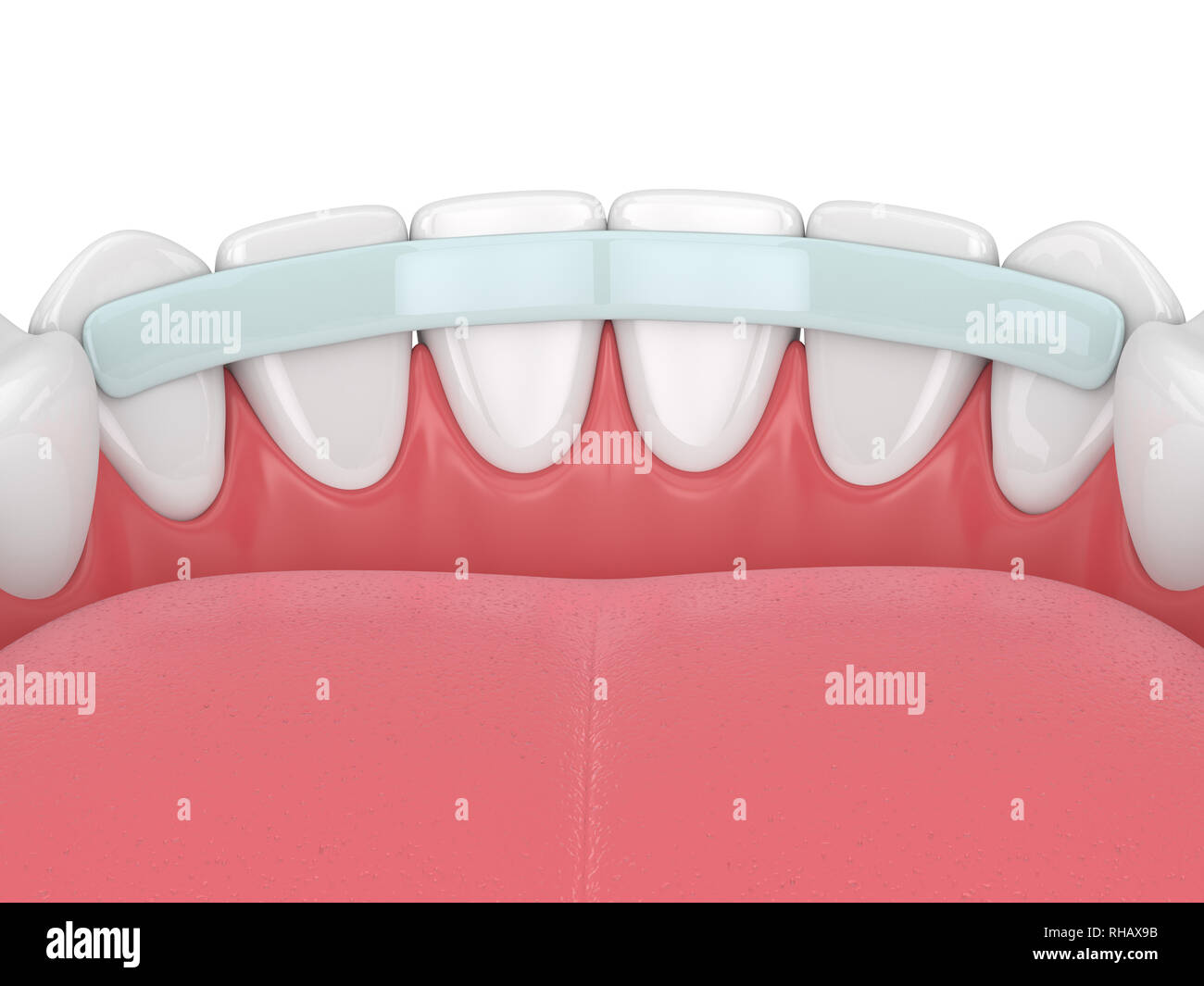 Periodontal fiber hi-res stock photography and images - Alamy