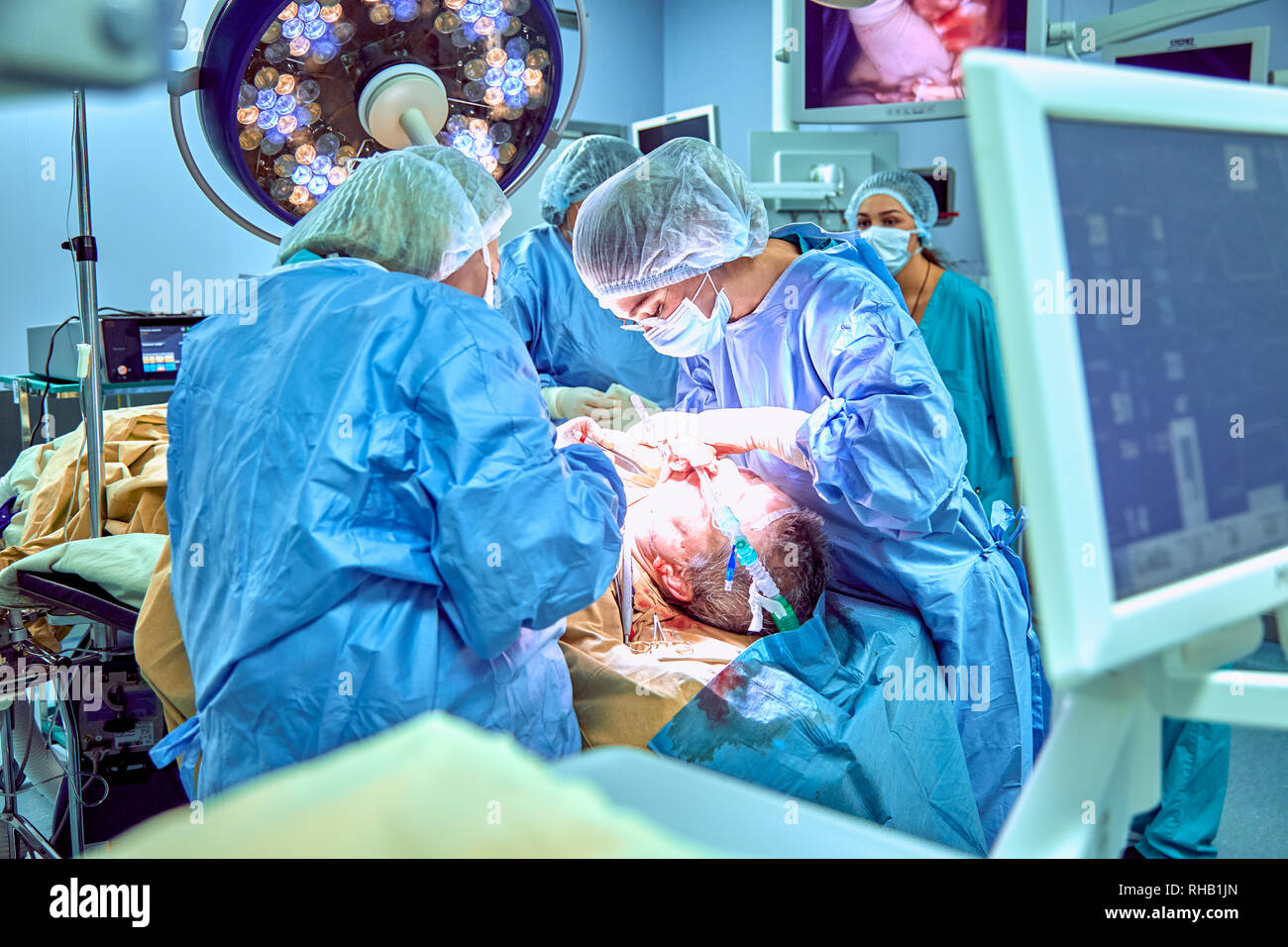 Chin reduction augmentation double chin removal plastic surgery ...