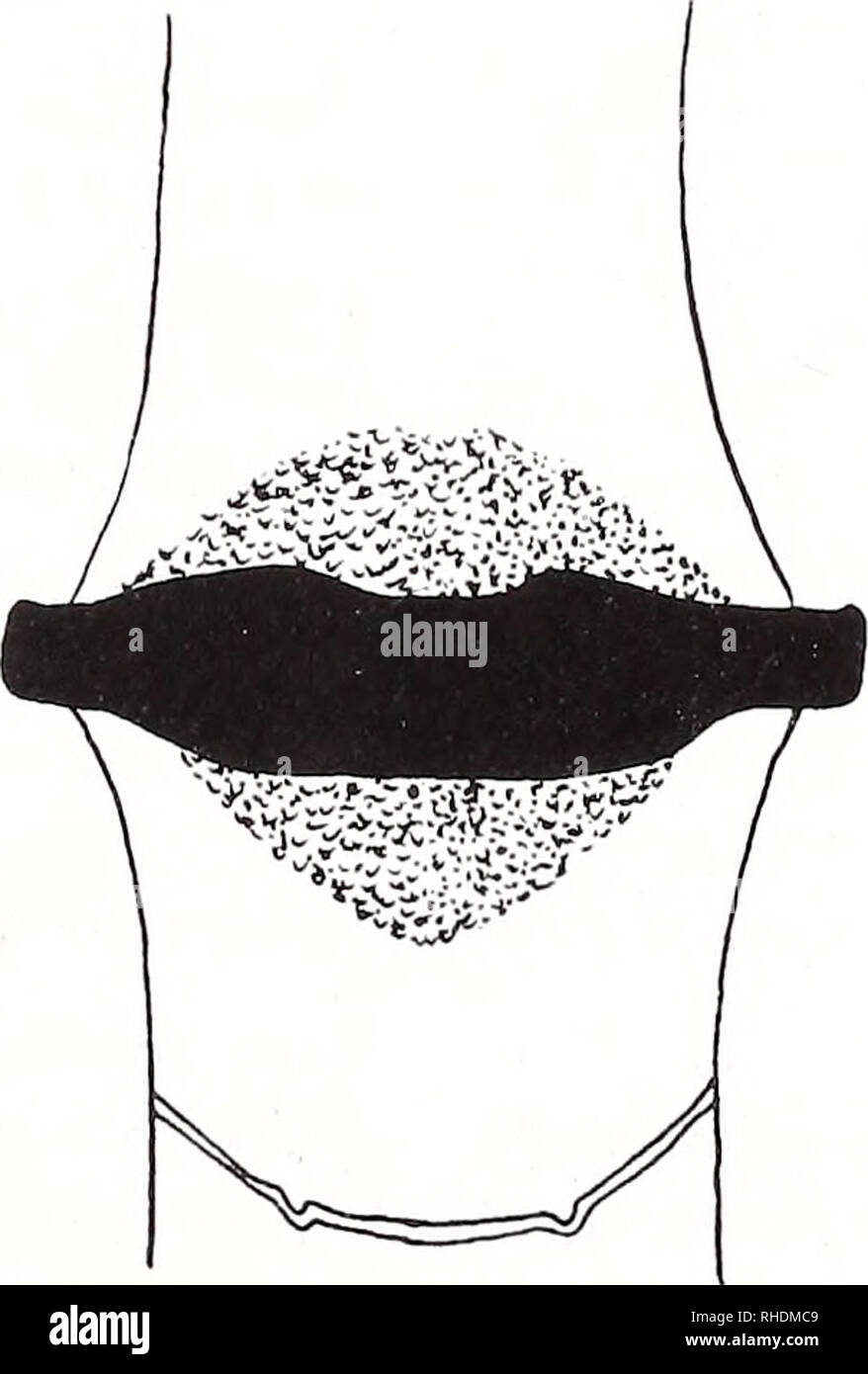 Punctured leg hi-res stock photography and images - Alamy