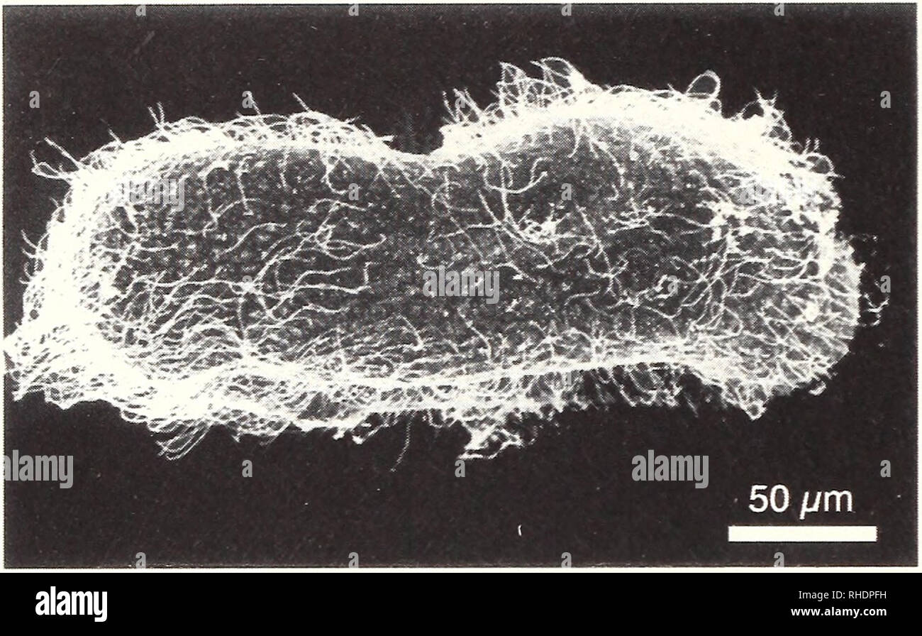 Cilia electron micrograph hi-res stock photography and images - Alamy