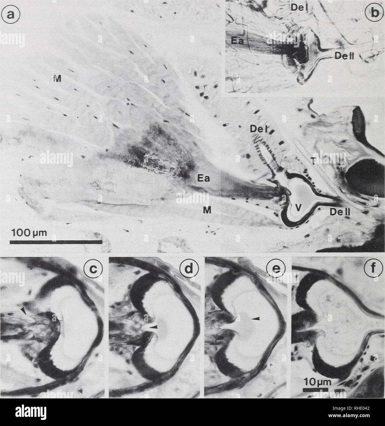 Frontaler hi-res stock photography and images - Alamy