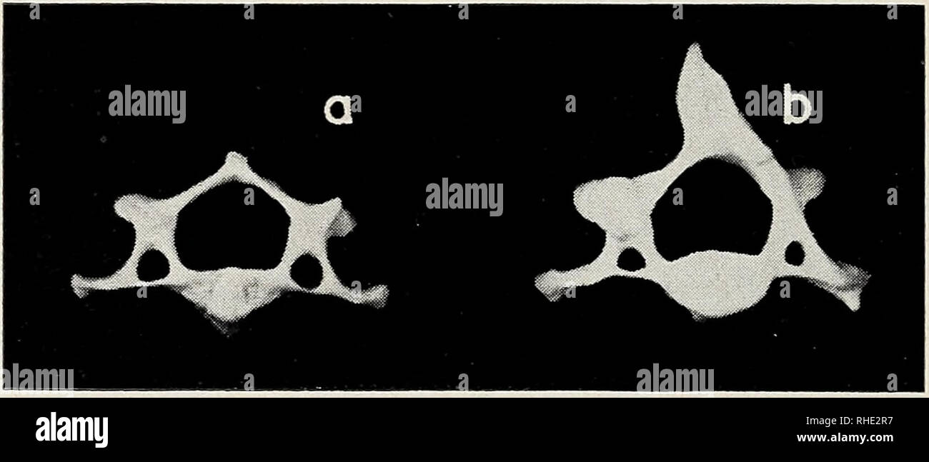 Transversi hi-res stock photography and images - Alamy