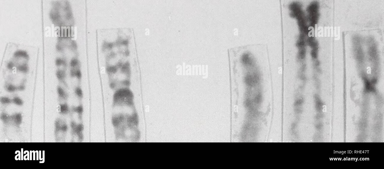 Classification of chromosomes hi-res stock photography and images - Alamy