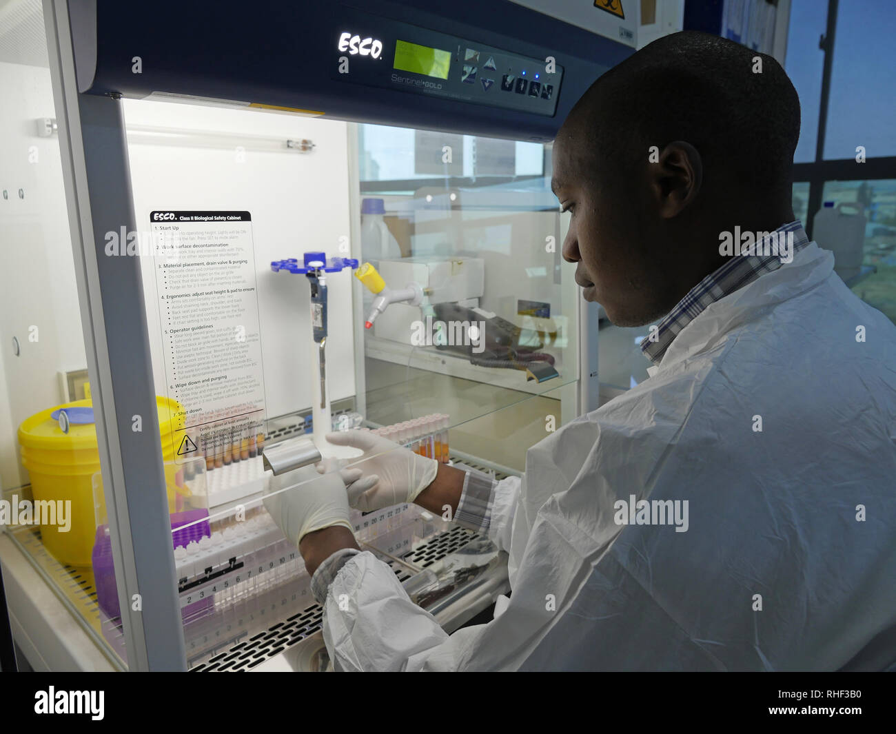 Hiv viral load test hi-res stock photography and images - Alamy