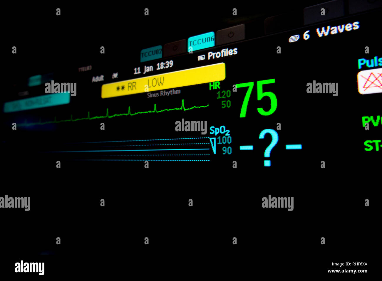 Hospital chart heart monitor hi-res stock photography and images - Alamy