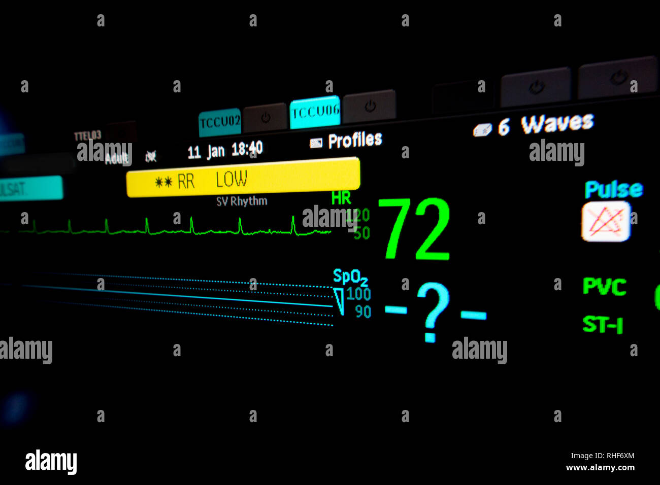 Hospital chart heart monitor hi-res stock photography and images - Alamy