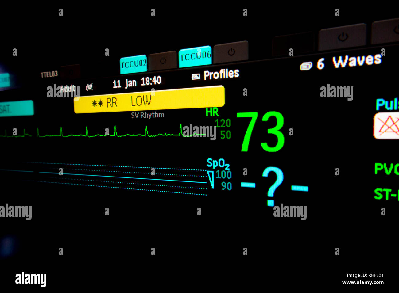 Hospital Heart Rate