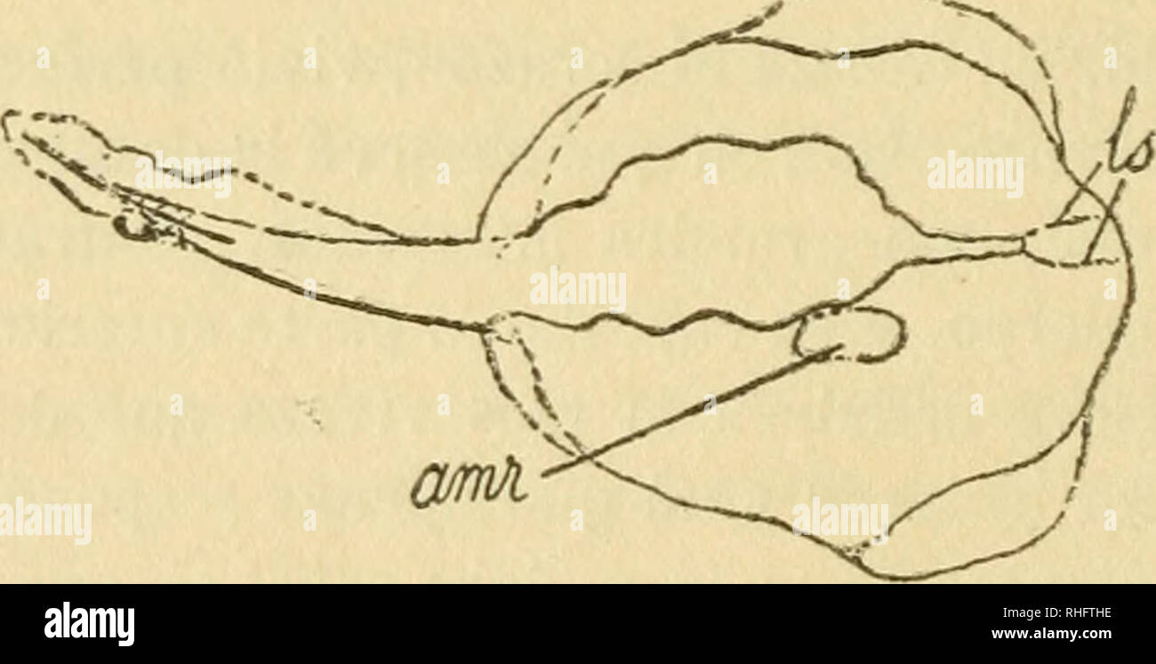 Esófago en dibujo hi-res stock photography and images - Alamy