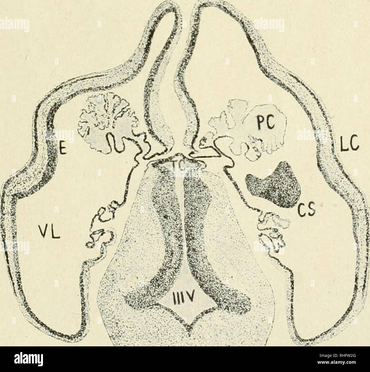 Cuerpo calloso del cerebro hi-res stock photography and images - Alamy