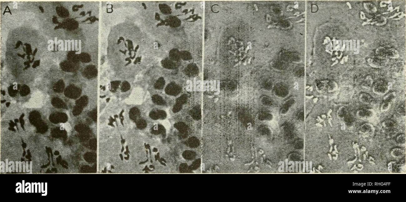 Brightfield microscope hi-res stock photography and images - Alamy