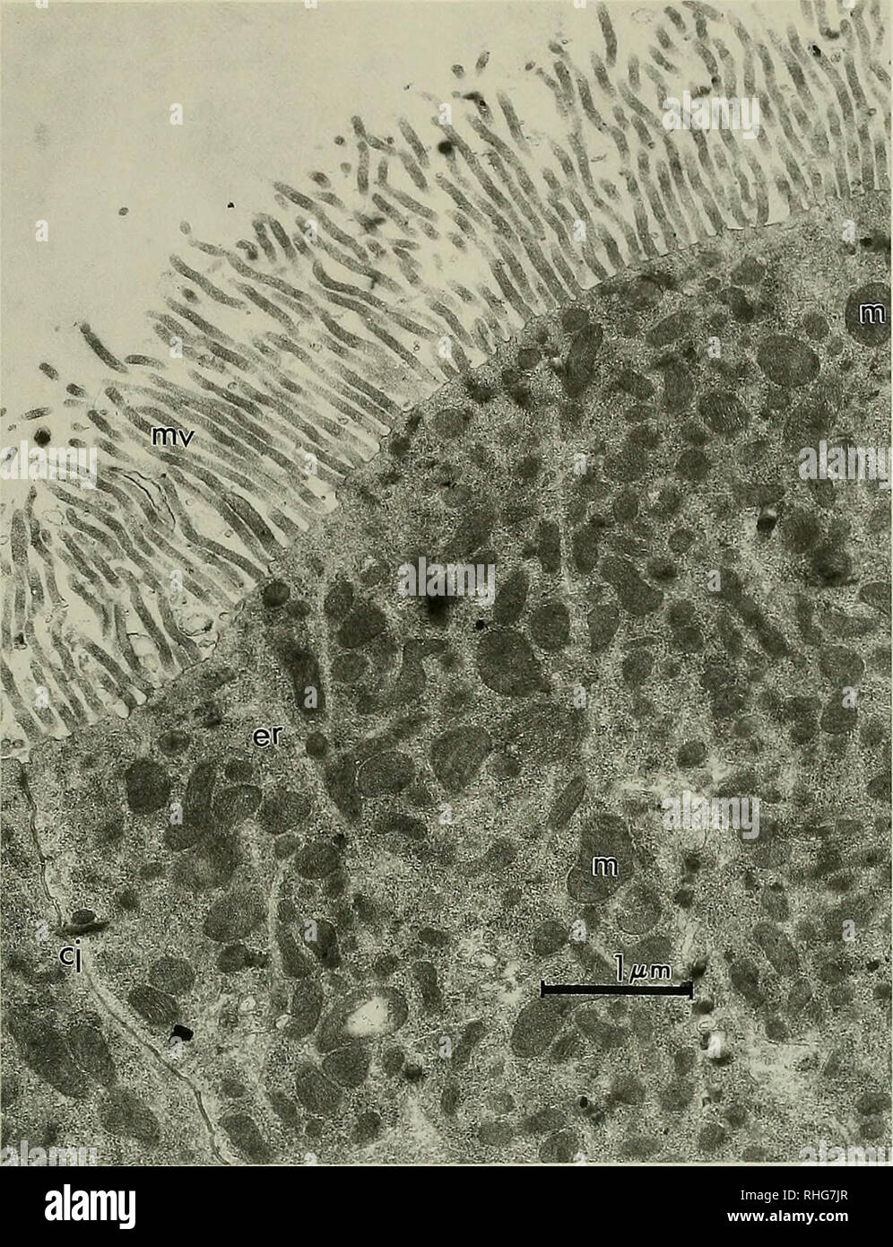 Endoplasmic reticulum micrograph hi-res stock photography and images ...