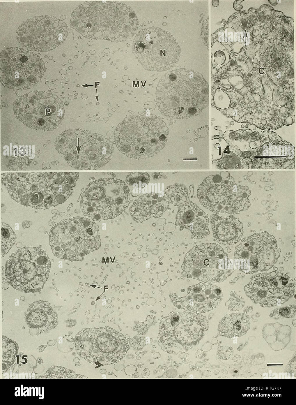 Choanocyte chamber hi-res stock photography and images - Alamy