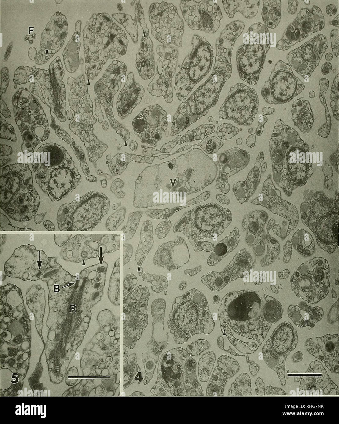 Pseudostratified epithelium hi-res stock photography and images - Alamy