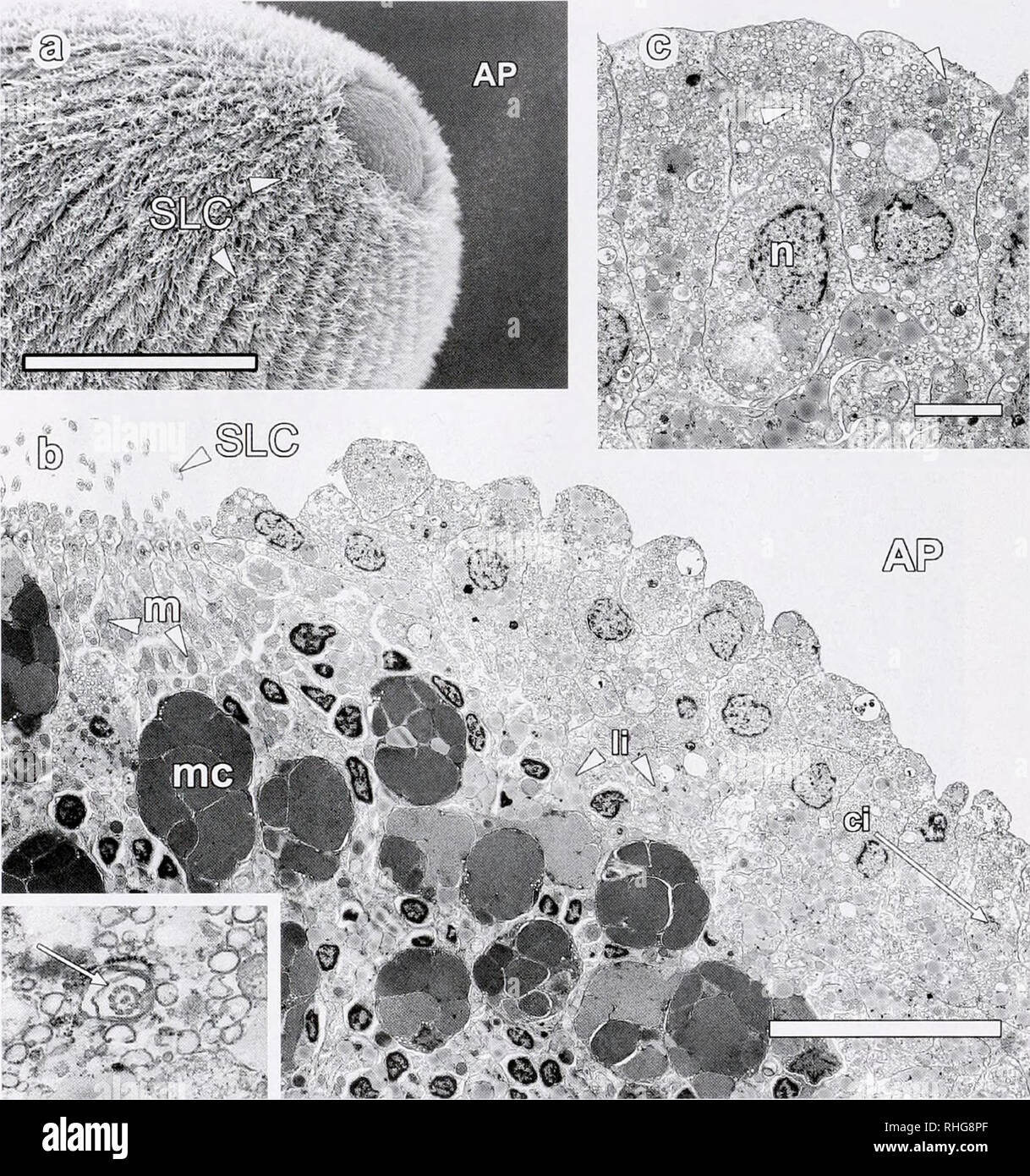 Cilia Electron Micrograph High Resolution Stock Photography and Images ...