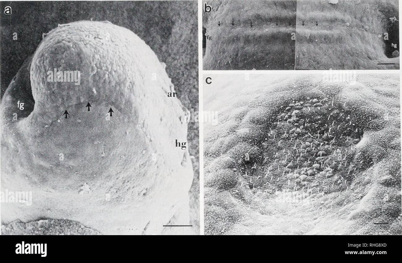 Scanning electron micrograph embryo hi-res stock photography and images ...