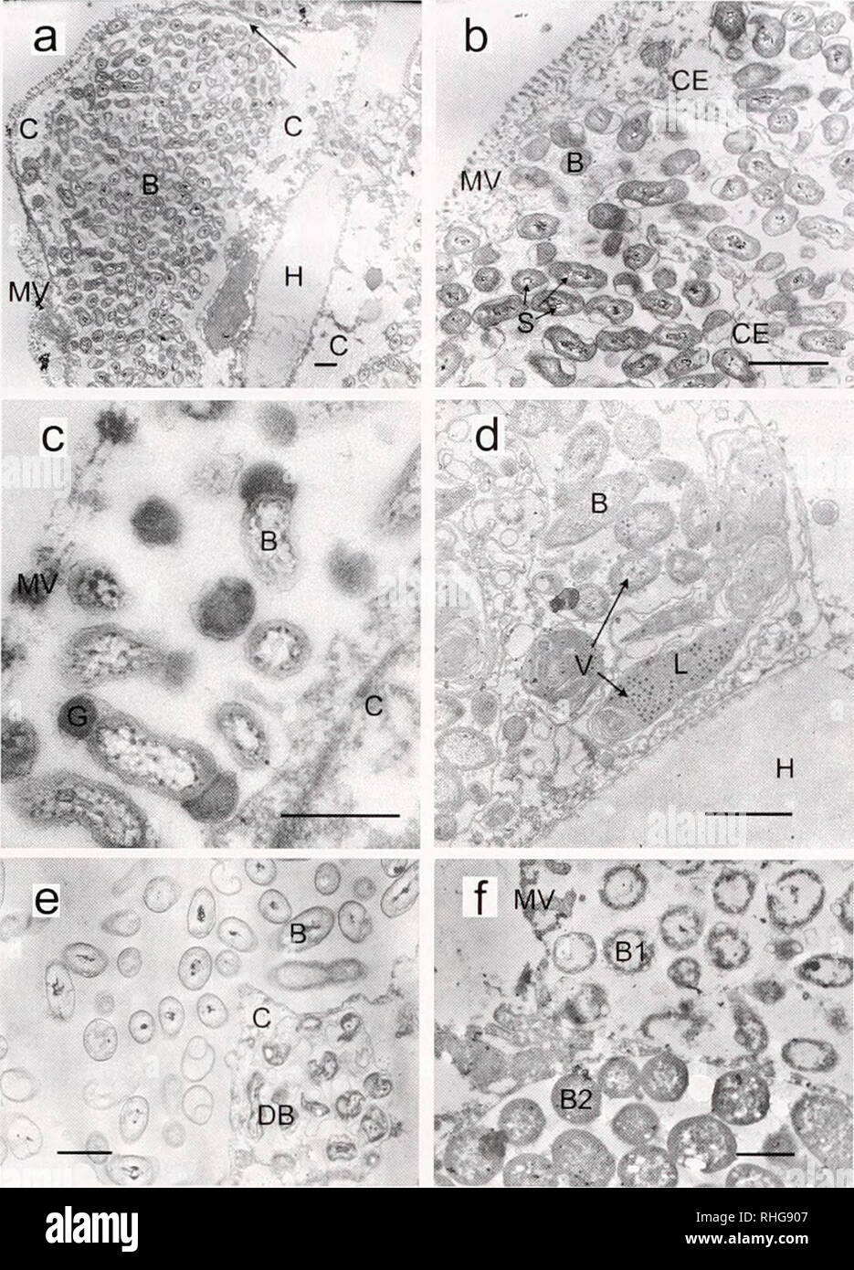 Hemocoel hi-res stock photography and images - Alamy