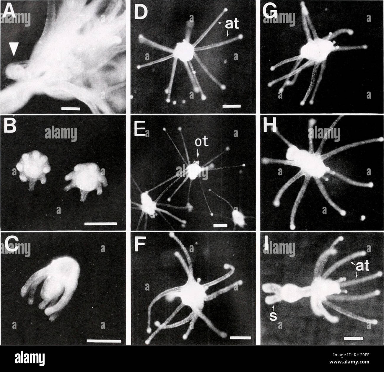 Polyp oral hi-res stock photography and images - Alamy