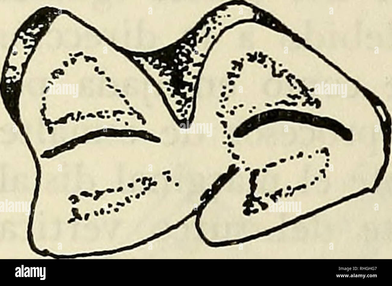 Raíces de los dientes hi-res stock photography and images - Alamy