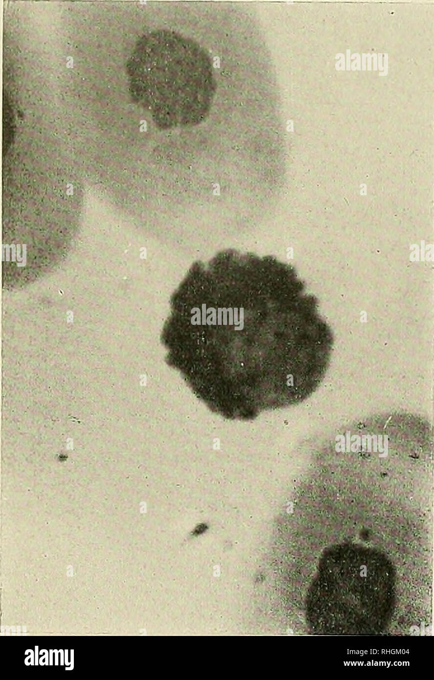 Leucocito basofilo hi-res stock photography and images - Alamy