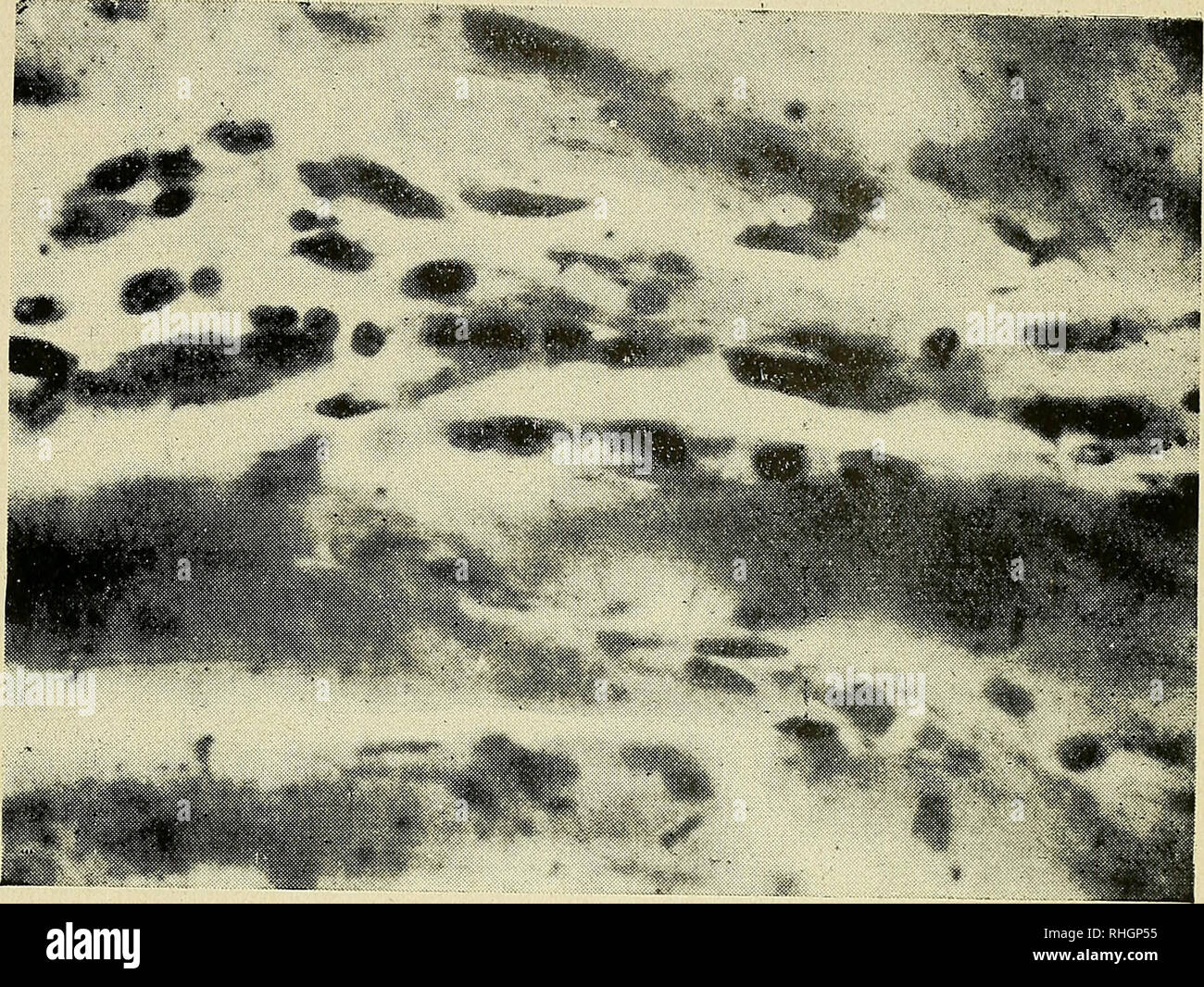 Eosina y hematoxilina hi-res stock photography and images - Alamy