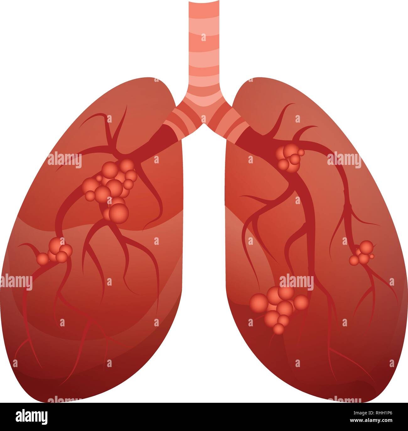 Smoking lungs icon. Cartoon of smoking lungs vector icon for web design ...
