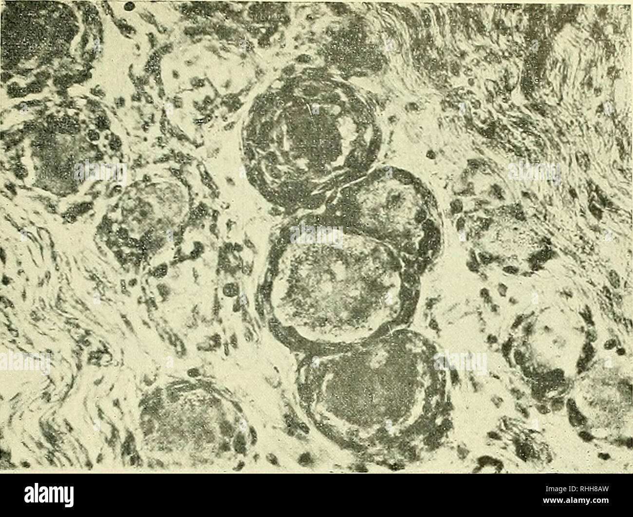 Proliferacion celular hi-res stock photography and images - Alamy