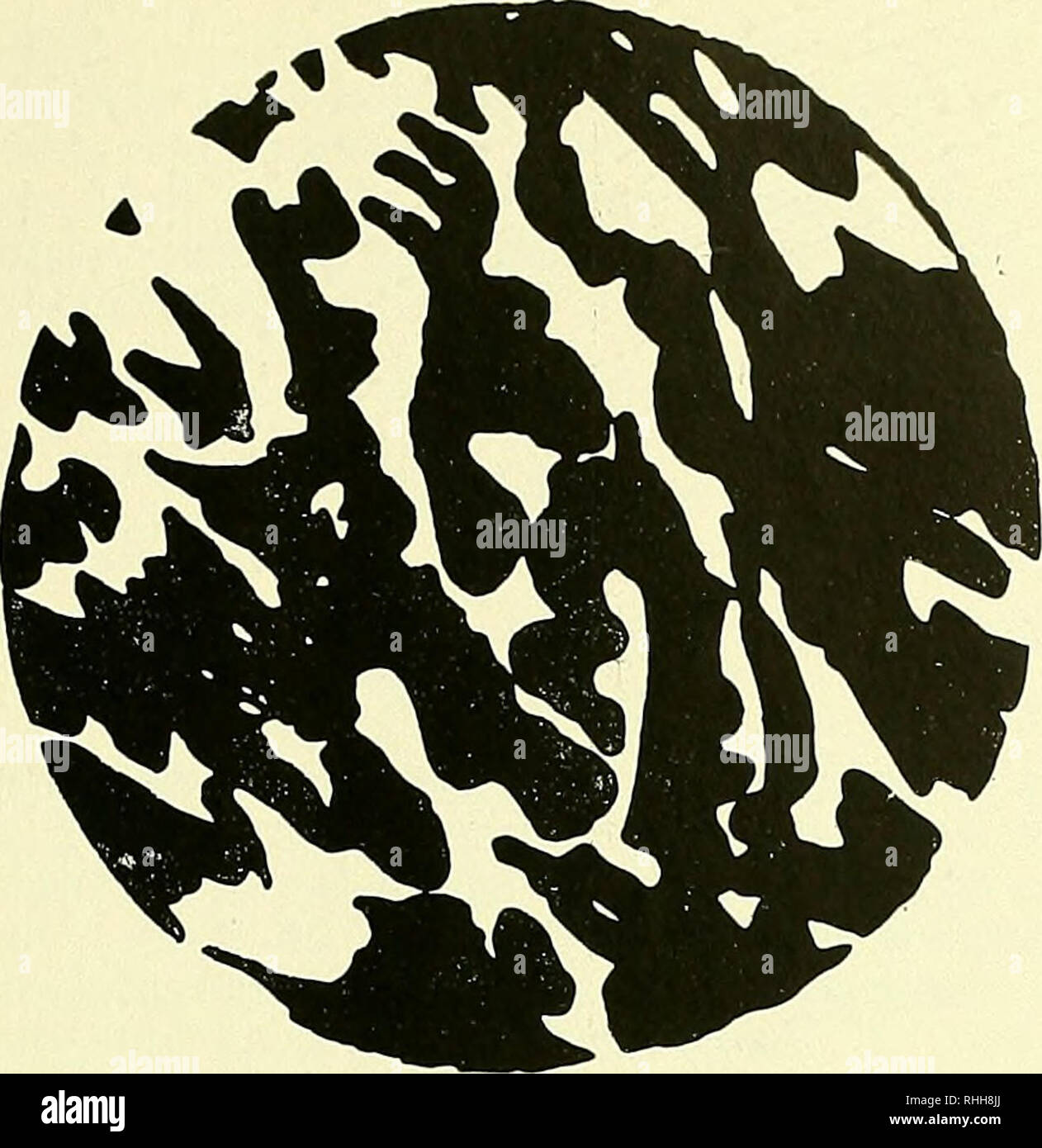 Cuerpo ciliar hi-res stock photography and images - Alamy