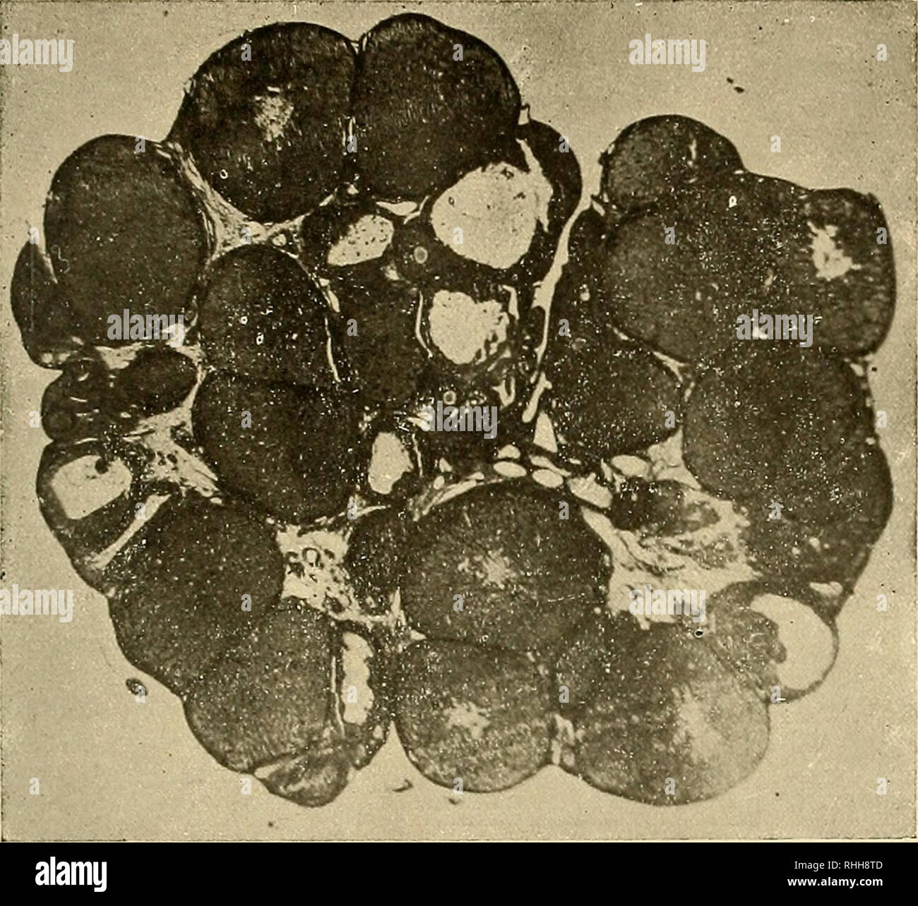 Peso normal hi-res stock photography and images - Alamy