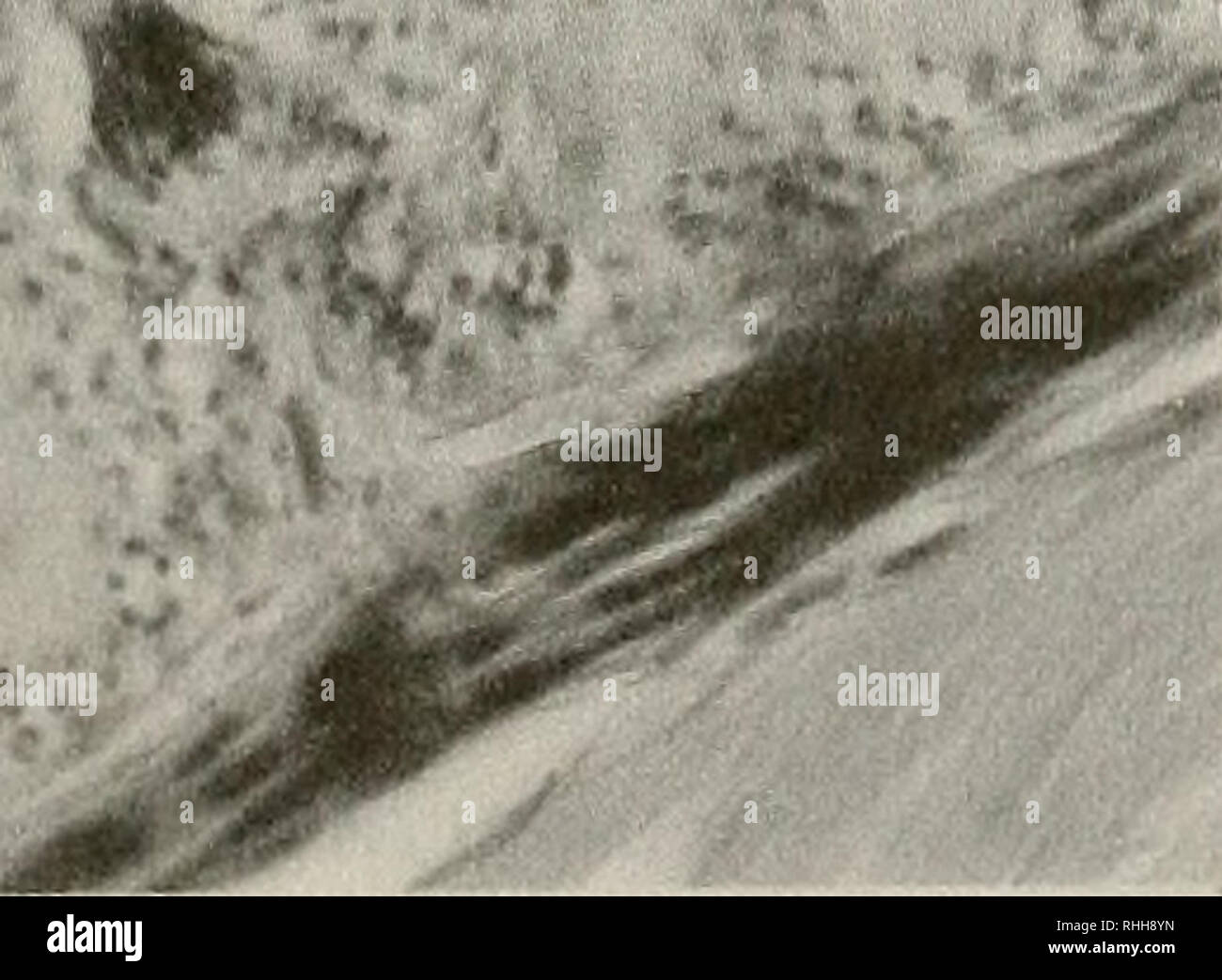 Epidermis capas hi-res stock photography and images - Alamy